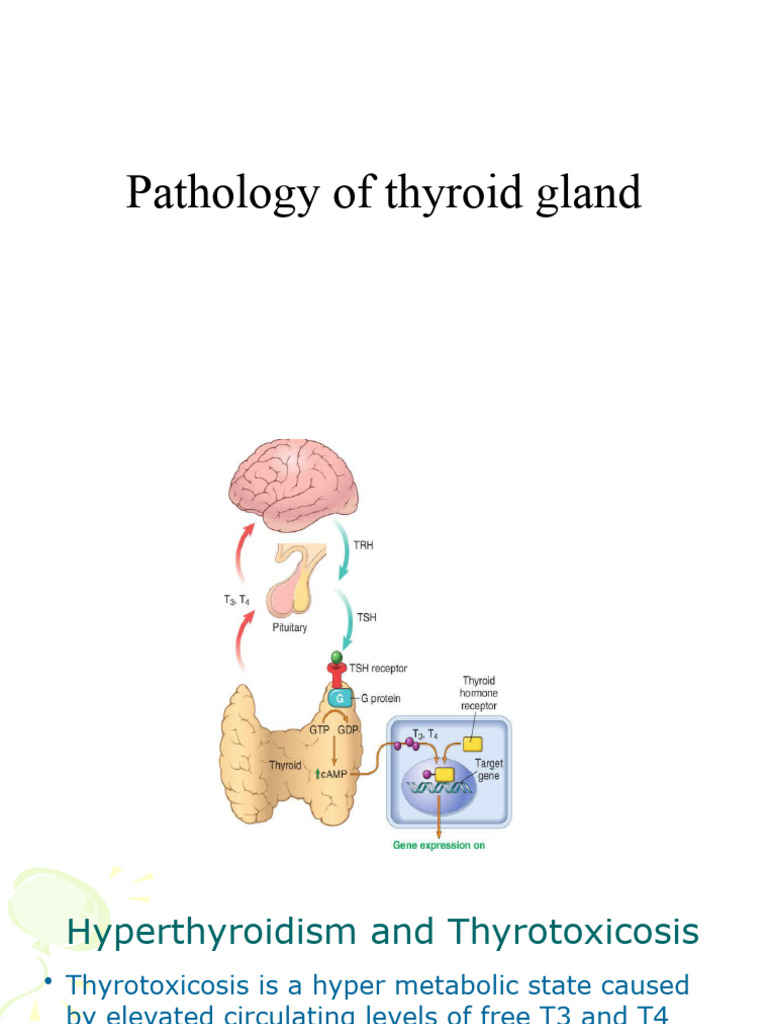 Thyroid Pathology: Hyperthyroidism Overview | PDF | Thyroid ...