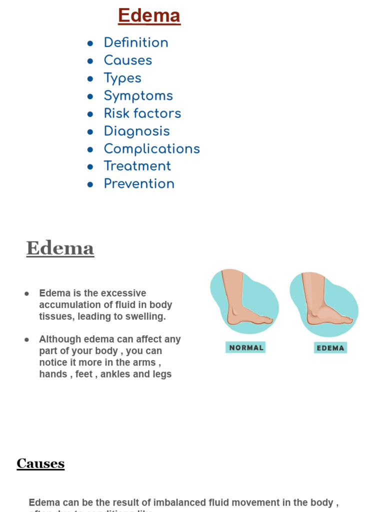 Edema | Download Free PDF | Edema | Clinical Medicine