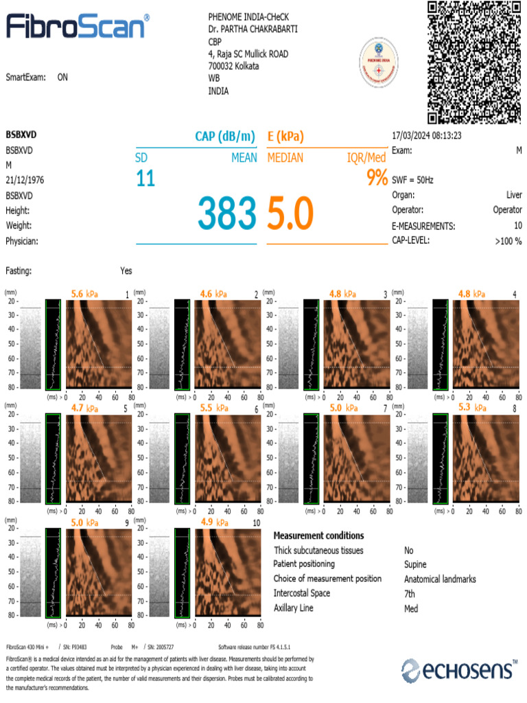 17-03-2024 08.31.07 25065 Fibroscan | PDF | Health Sciences | Clinical Medicine