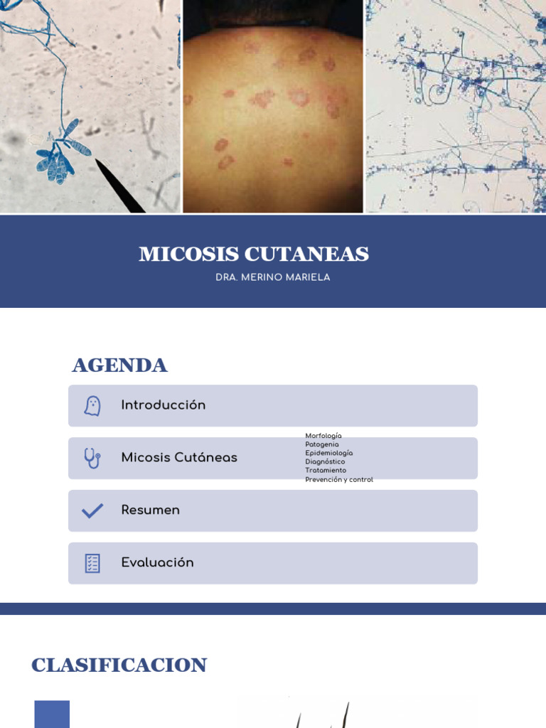 5 Micosis Cutaneas | PDF | Hongo | Micología