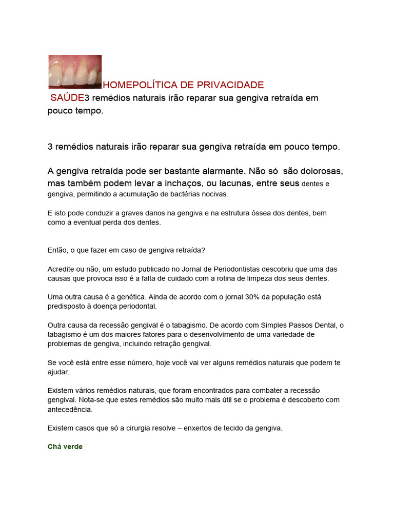 1tratamento para Gengiva Retraída | PDF | Especialidades médicas | Boca