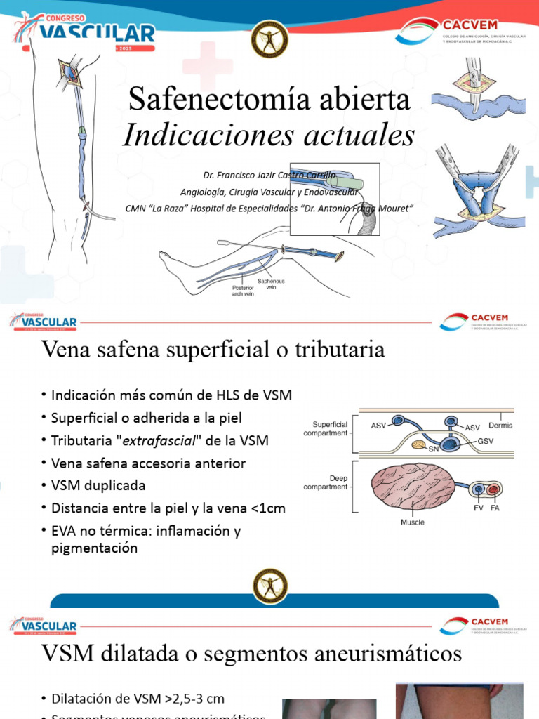 Indicaciones de Safenectomía Abierta | PDF | Enfermedades vasculares ...