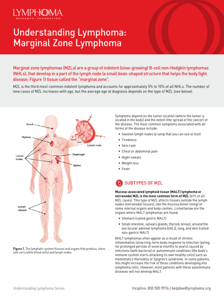 LRF Understanding Lymphoma Marginal Zone Lymphoma Fact Sheet | PDF ...