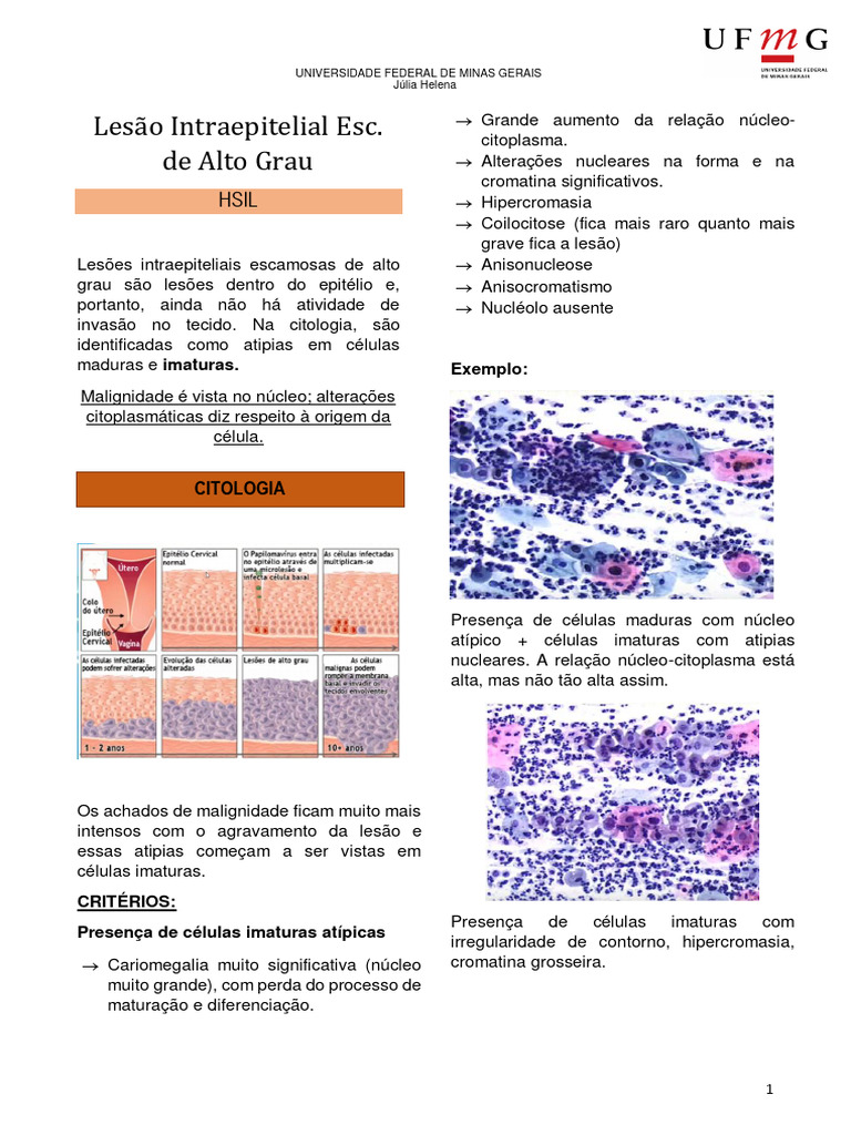 HSIL - Lesão Intraepitelial de Alto Grau (Papanicolau) | PDF | Núcleo ...