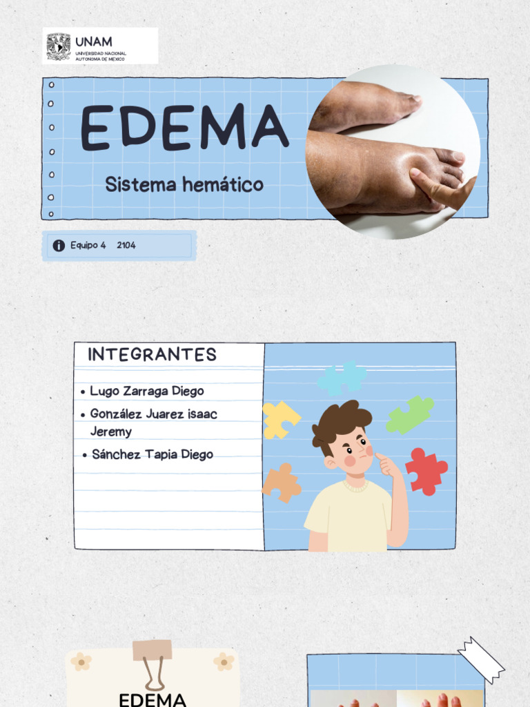 Tipos de Edema y Síndrome Edematoso | PDF | Edema | Especialidades Medicas