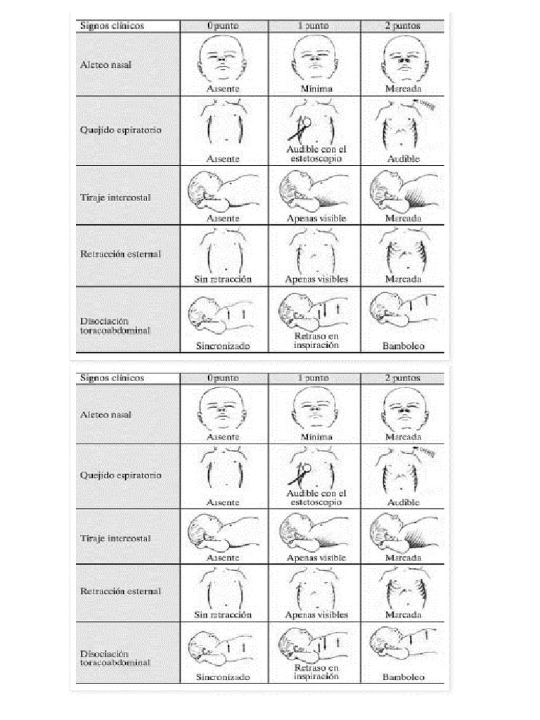 Test Silverman | PDF