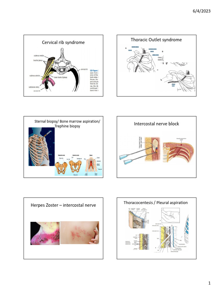 Thorax Cinical Anatomy-1 | PDF