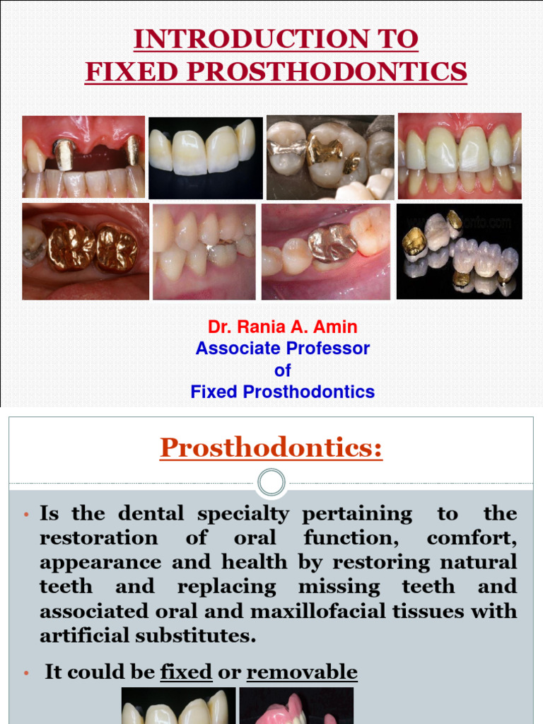 Introduction To Fixed Prosthodontics | PDF | Prosthodontics | Dentistry