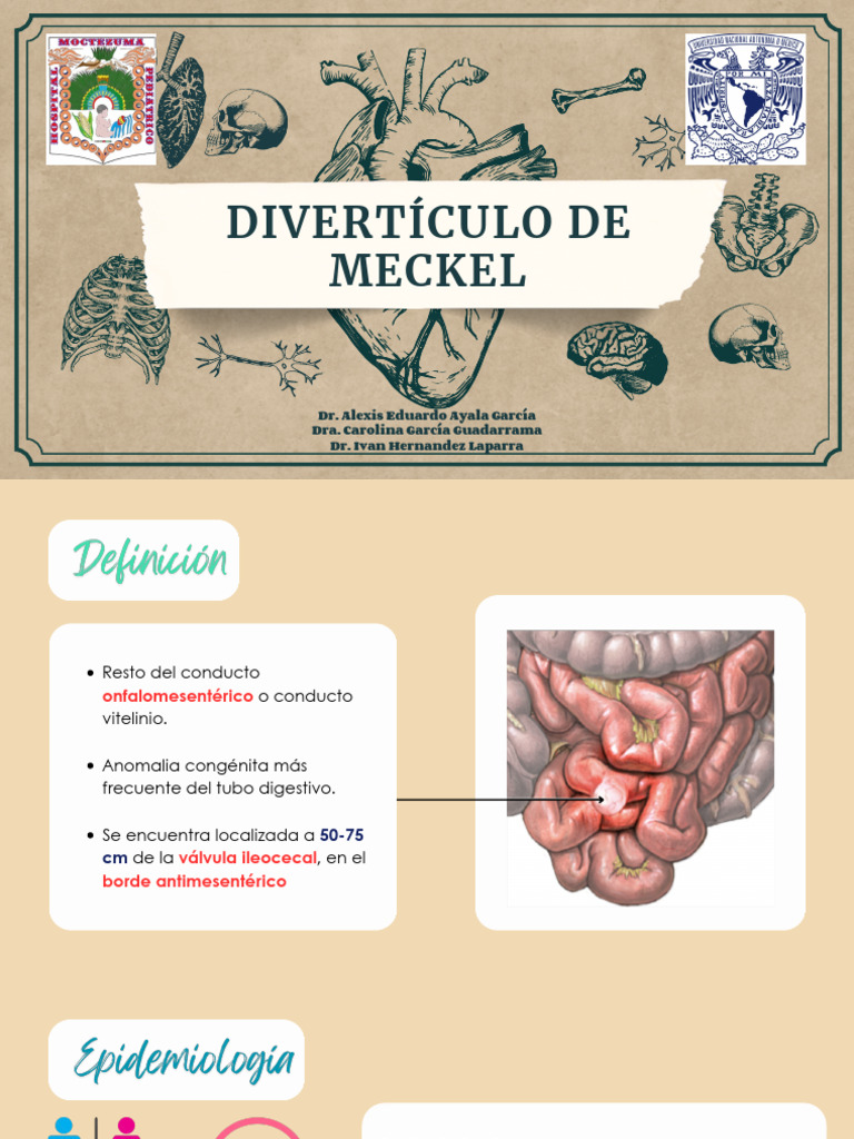Divertículo de Meckel: Guía Clínica | PDF | Páncreas | Gastroenterología