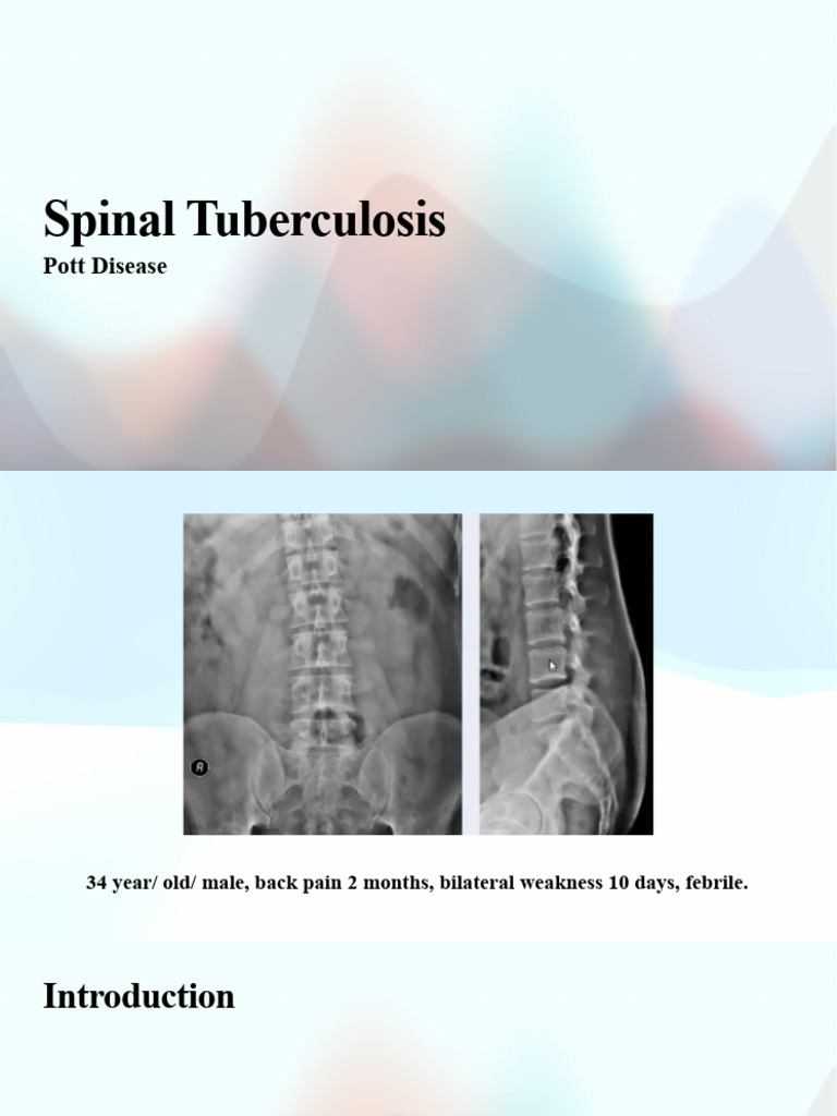Spinal TB | PDF | Tuberculosis | Vertebral Column