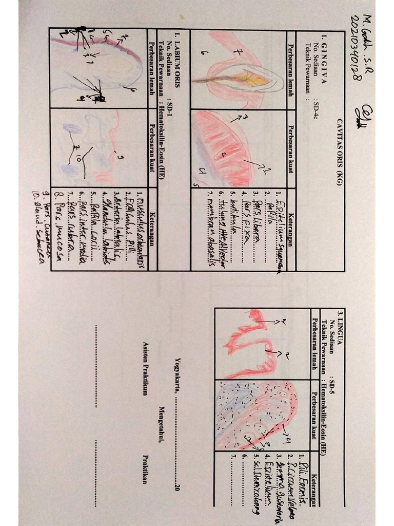 Laprak Cavital Oris | PDF