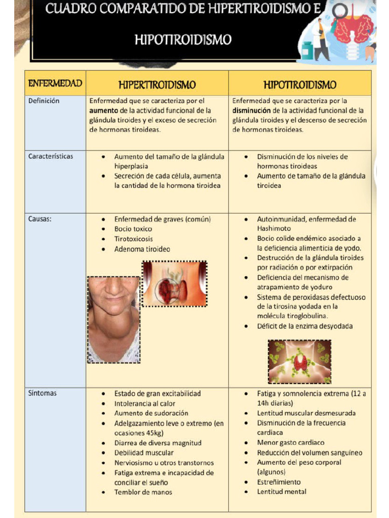 Cuadro Híper-Hipotiroidismo | PDF