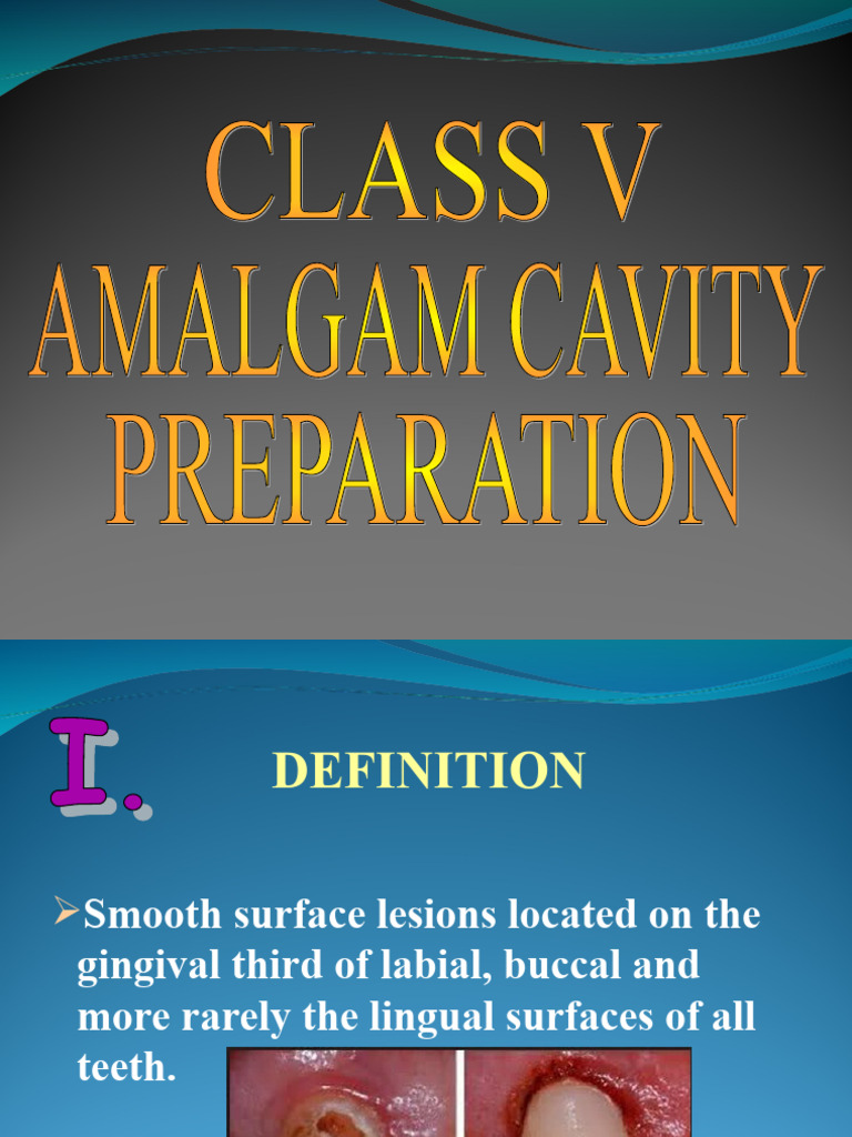 Class V Amalgam Cavity | PDF | Human Tooth | Mouth