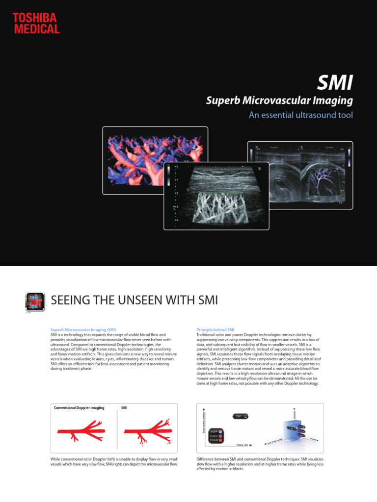 SMI An Essential Ultrasound Tool | PDF | Medical Ultrasound | Heart