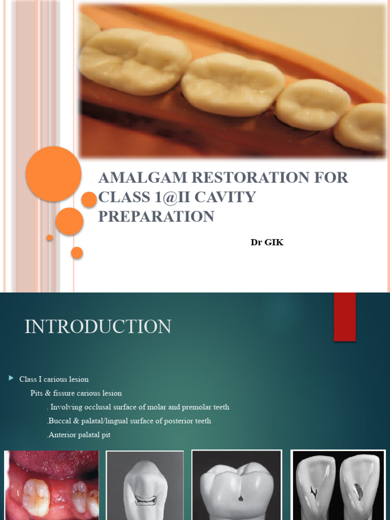 Amalgam Class 1@2 | PDF | Tooth Enamel | Human Tooth