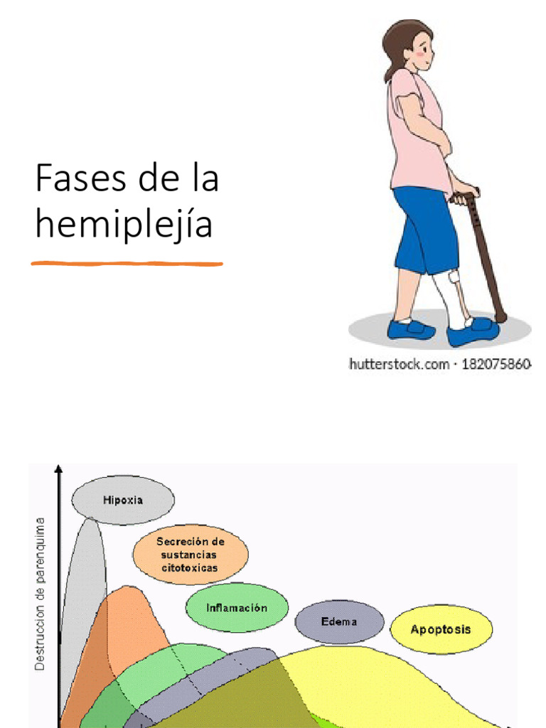 Fases de La Hemiplejía y Objetivos de Tratamiento Post ACV | PDF ...