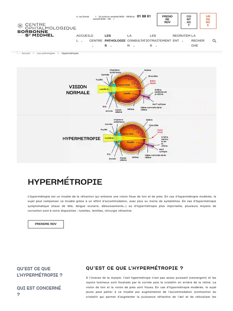 Comprendre l'hypermétropie | PDF | Myopie | Vision