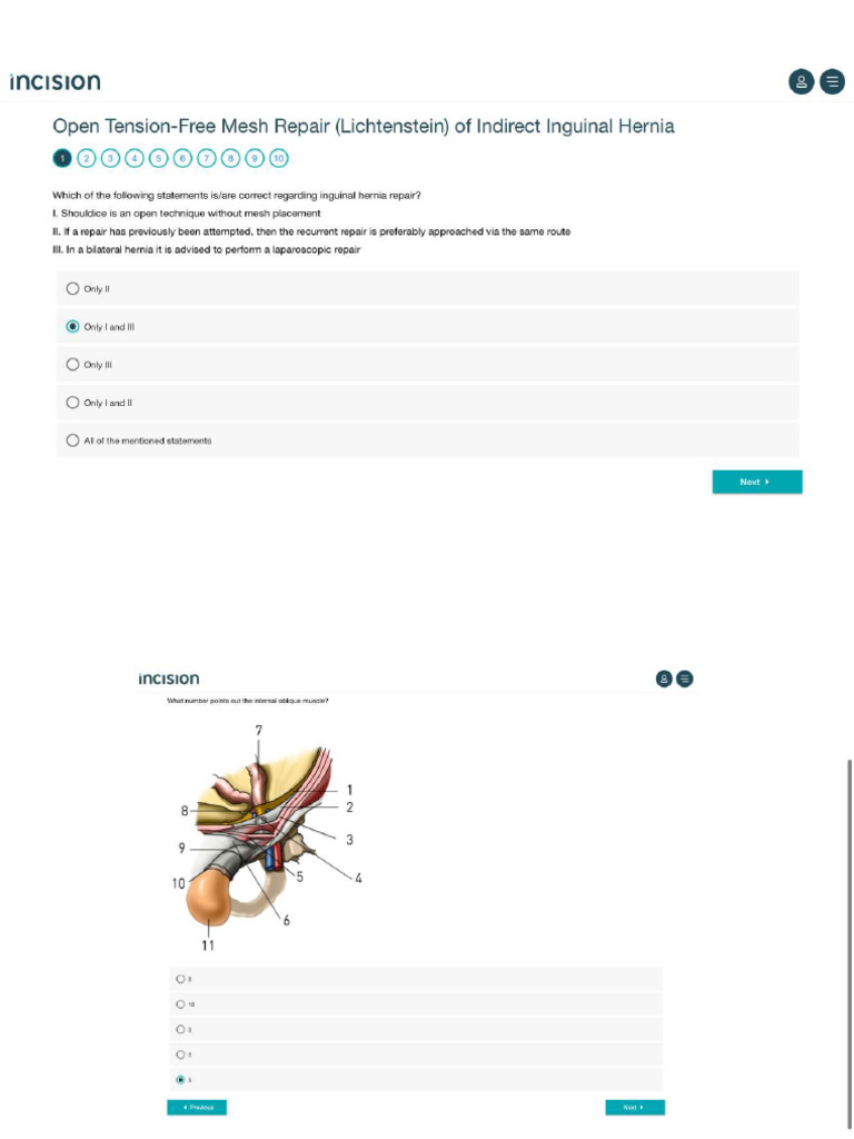 Open Tension Free Mesh Repair Lichtenstein of Indirect Inguinal | PDF
