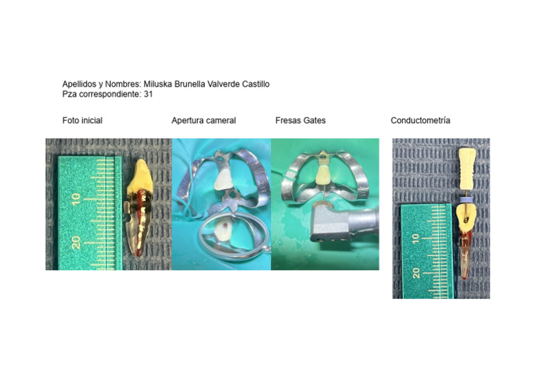 Procedimiento de Conductometría Dental | PDF