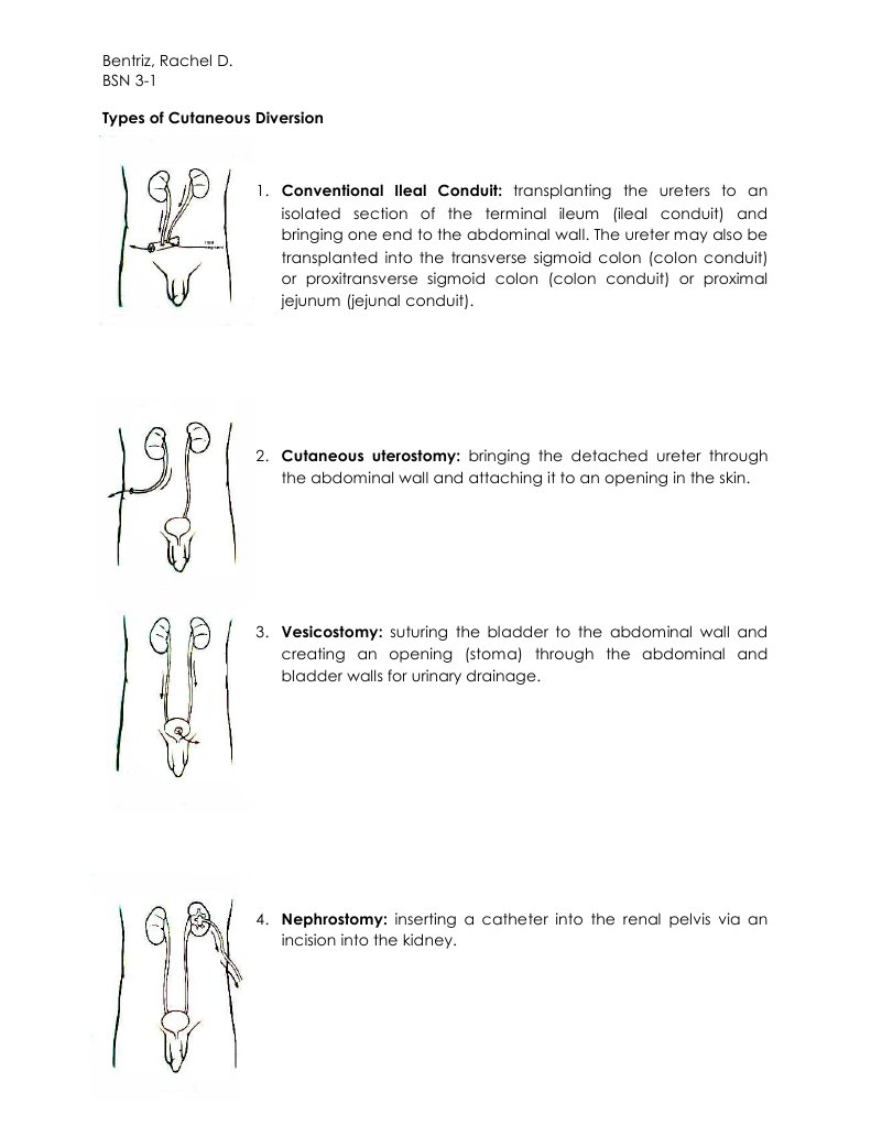 Types of Cutaneous Diversion and Continent Urinary Diversion | PDF