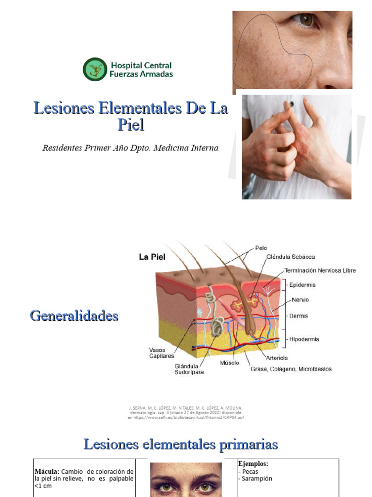 Lesiones Elementales de La Piel | PDF | Piel | Dermatología