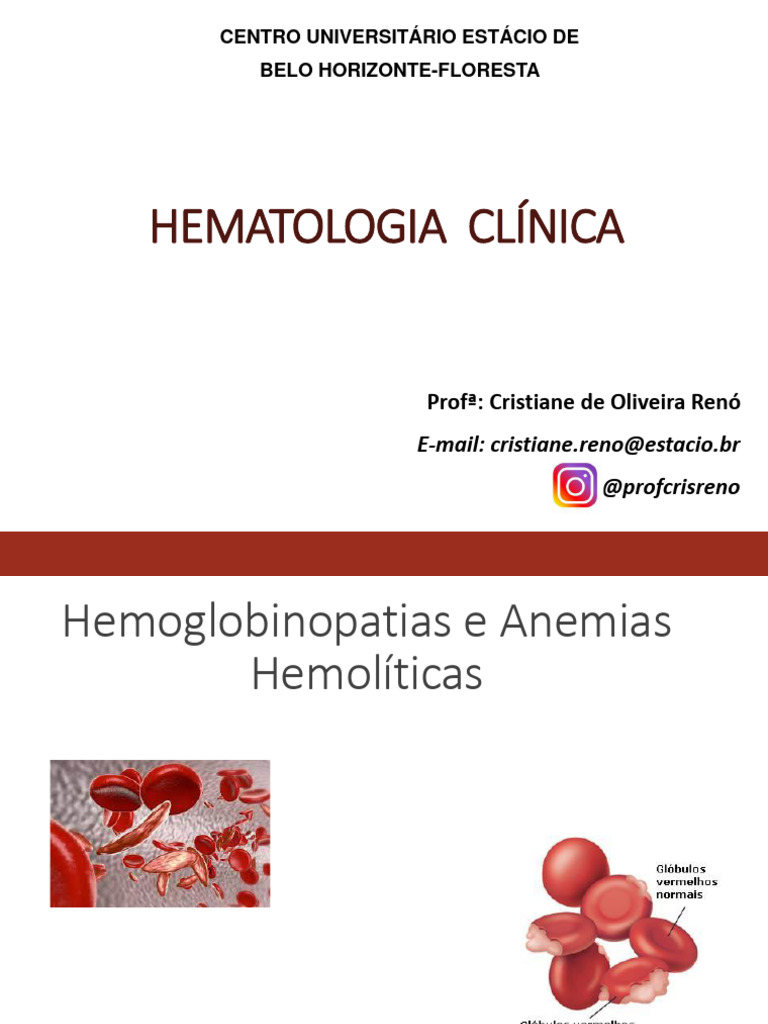 Aula 6 - Hemoglobinopatias Anemias Hemol Ticas. | PDF | Hemoglobina | Hemácia