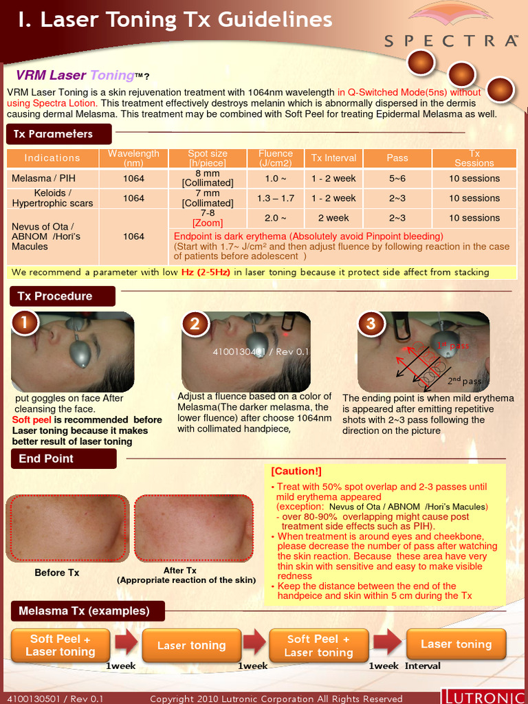 SPECTRA Laser Toning TxGuidelines | PDF | Skin | Dermatology