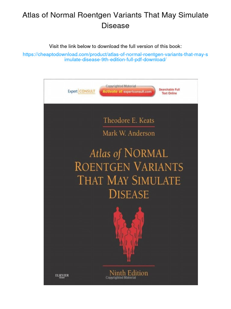 Atlas of Normal Roentgen Variants That May Simulate Disease. ISBN ...