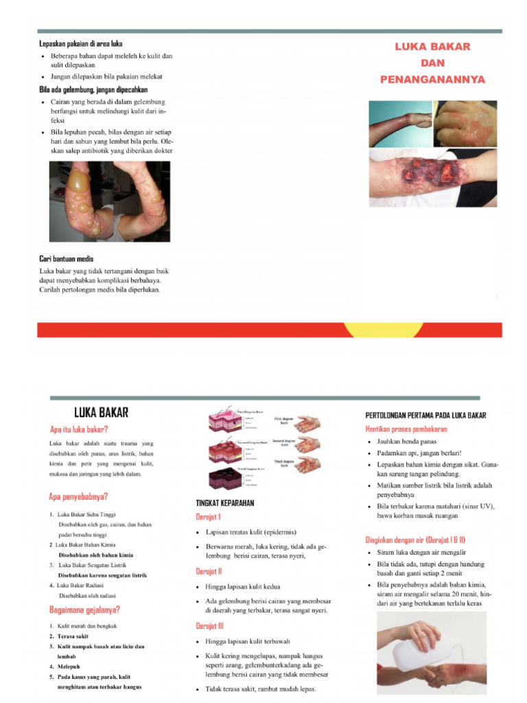 Leaflet Luka Bakar | PDF