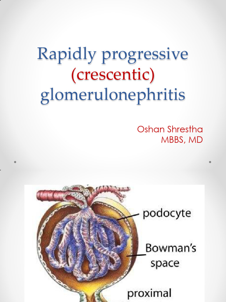 Rapidly Progressive (Crescentic) Glomerulonephritis MBBS | PDF ...