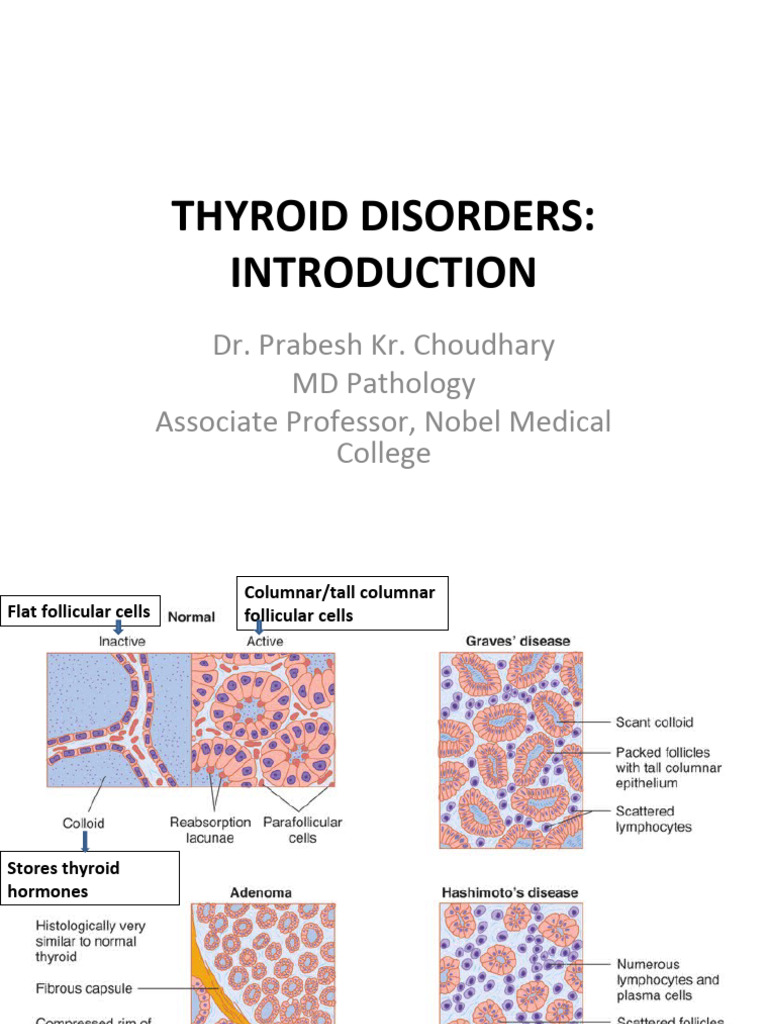 Understanding Thyroid Disorders And Hyperthyroidism Pdf