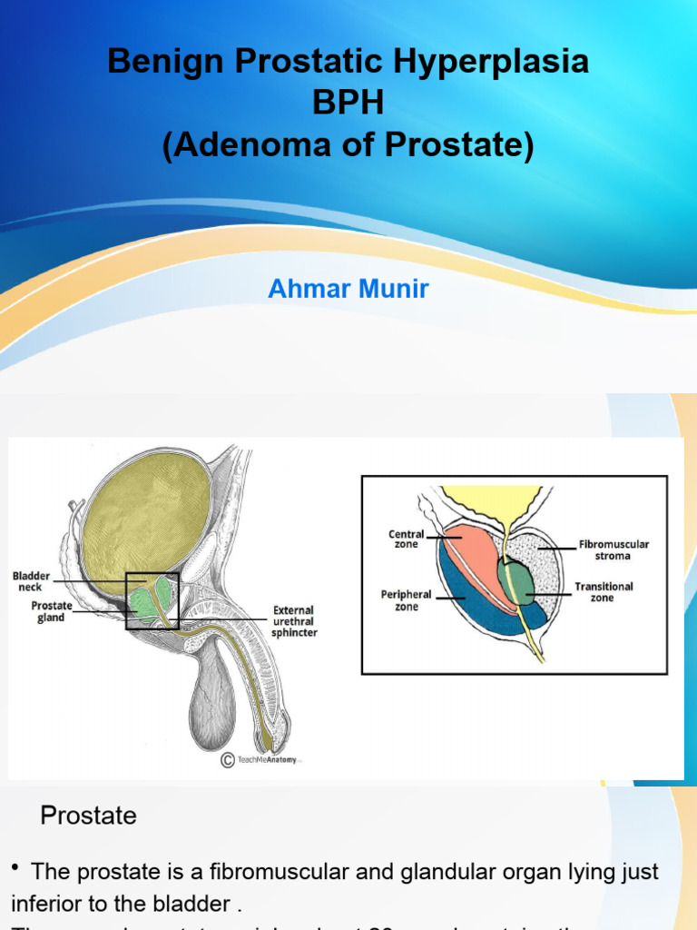 Benign Prostatic Hyperplasia | PDF | Prostate | Urinary Incontinence