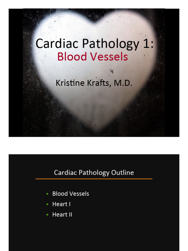 Overview of Cardiac Pathology | PDF | Blood Vessel | Heart