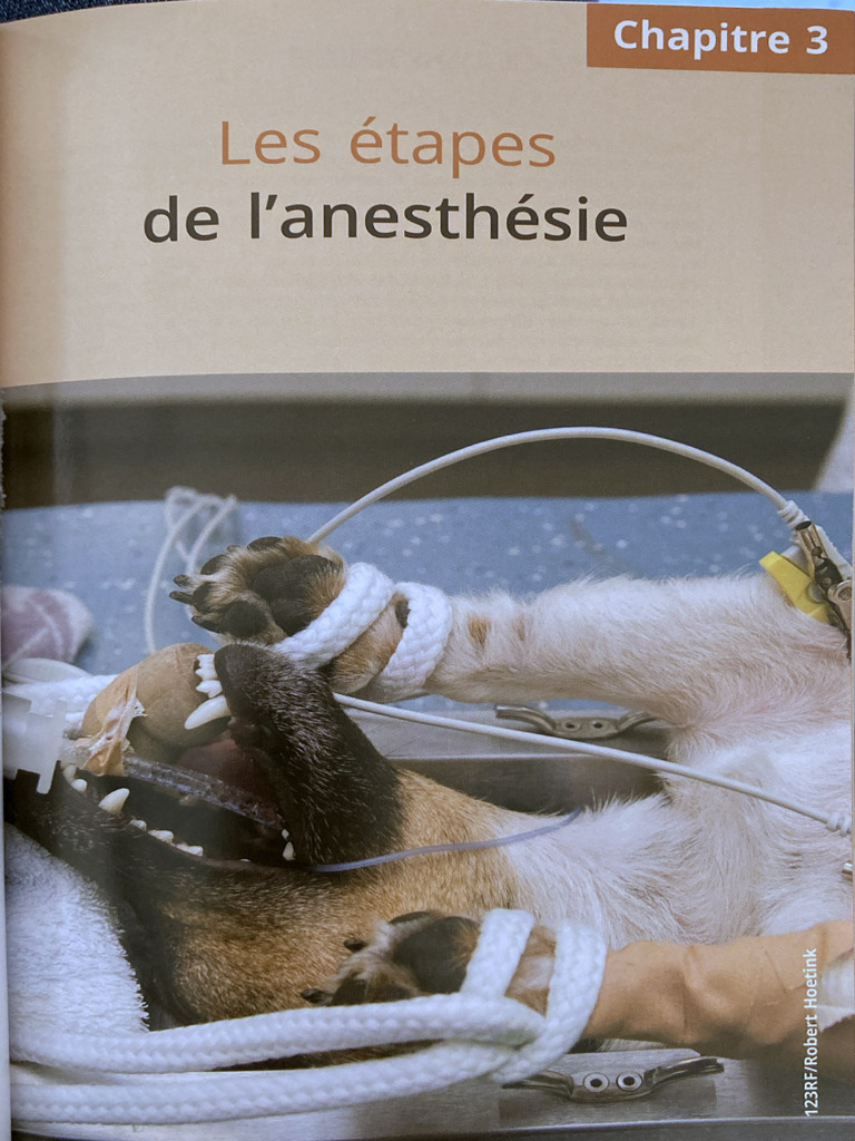 Anesthésie Étapes | PDF