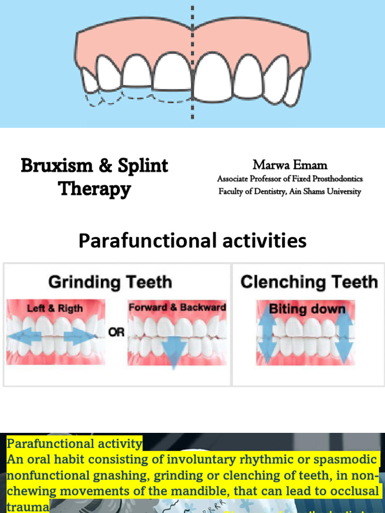 Bruxism Treatment with Splint Therapy | PDF