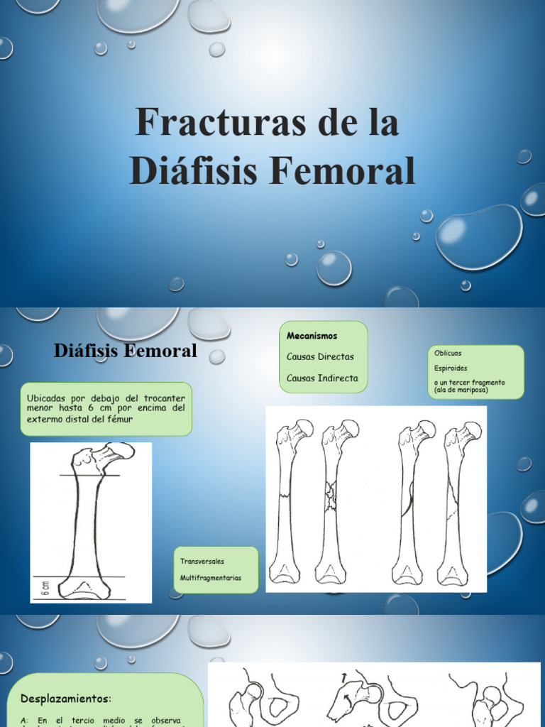 Fxs Femur, Rotula, Tibia y Pie | PDF | Rodilla | Articulaciones