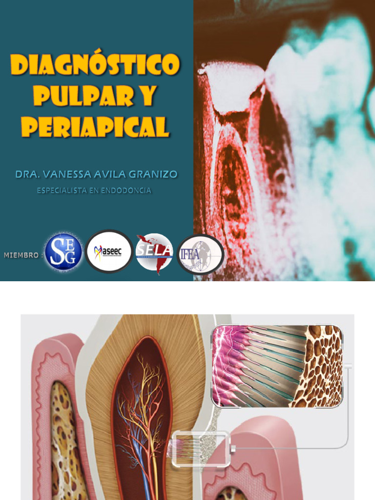 1.diagnostico Endodóntico | PDF | Inflamación | Medicina CLINICA