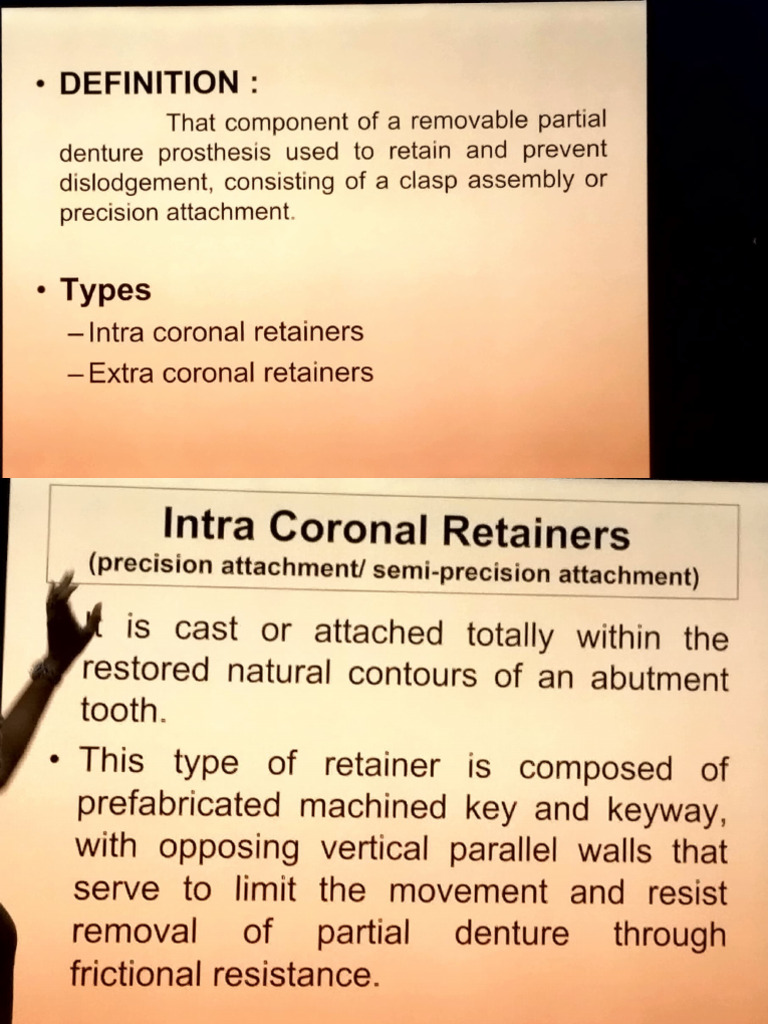 Direct Retainers Prostho | PDF | Medical Specialties | Dentistry Branches
