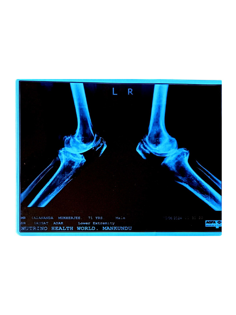 Leg X-Ray | PDF