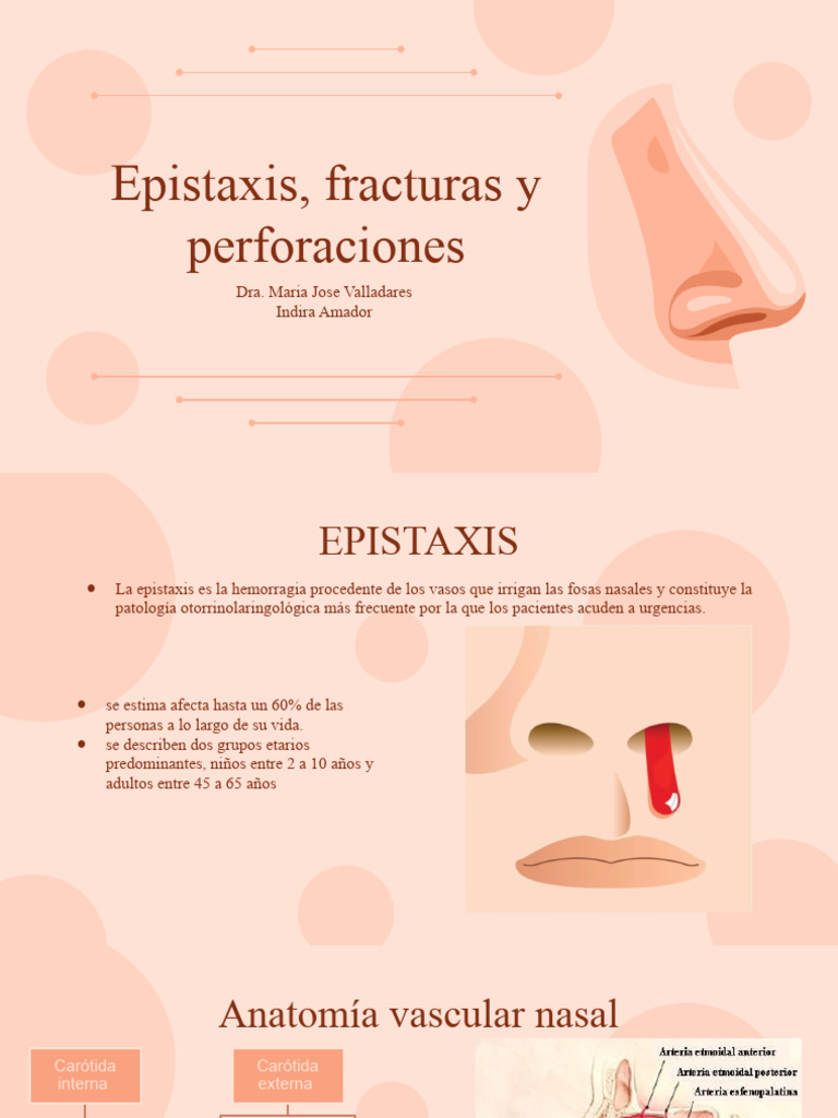 EPISTAXIS | PDF | Anatomía humana | Cabeza y cuello humanos