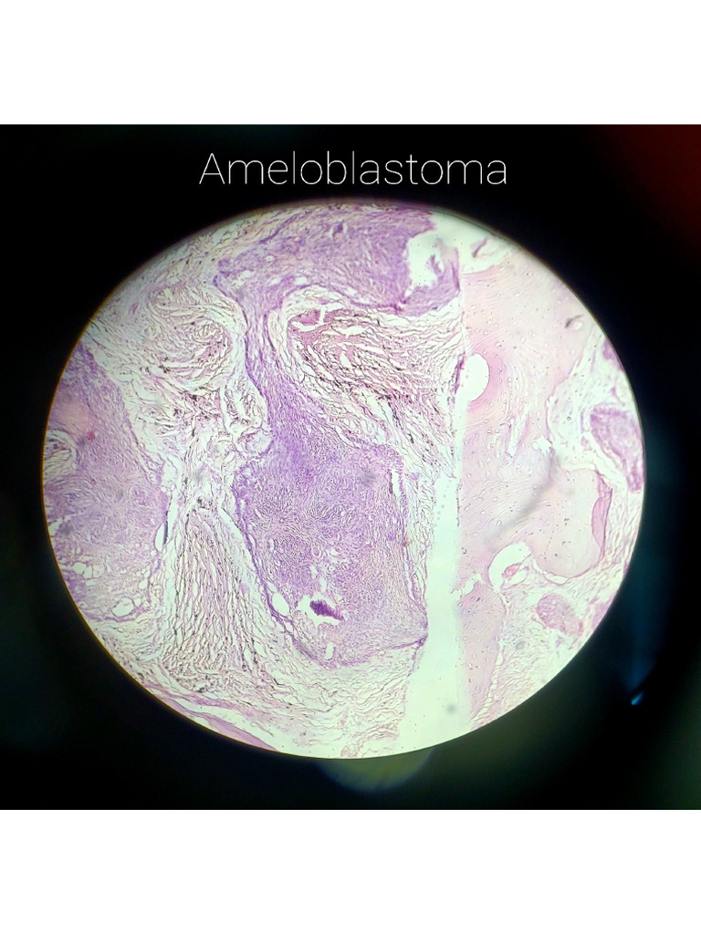 Pathology Slides | PDF