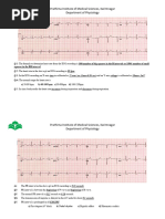 Delta Wave - LITFL Medical Blog - ECG Library Basics | PDF | Cardiac ...