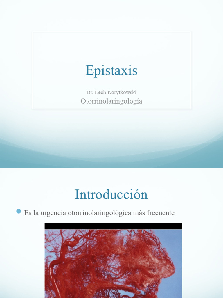 Epistaxis | PDF | Coagulación | Especialidades Medicas