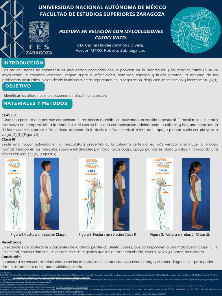 Postura Y Maloclusiones Esqueletales Pdf La Columna Vertebral
