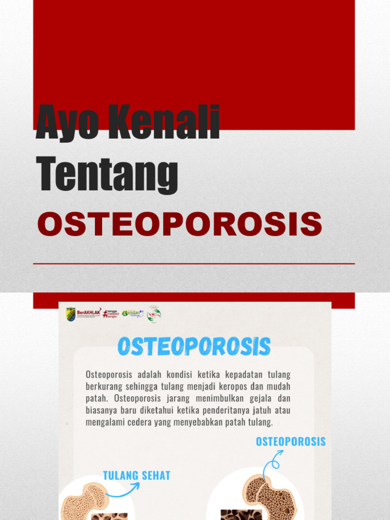 Ayo Kenali Tentang Osteoporosis | PDF