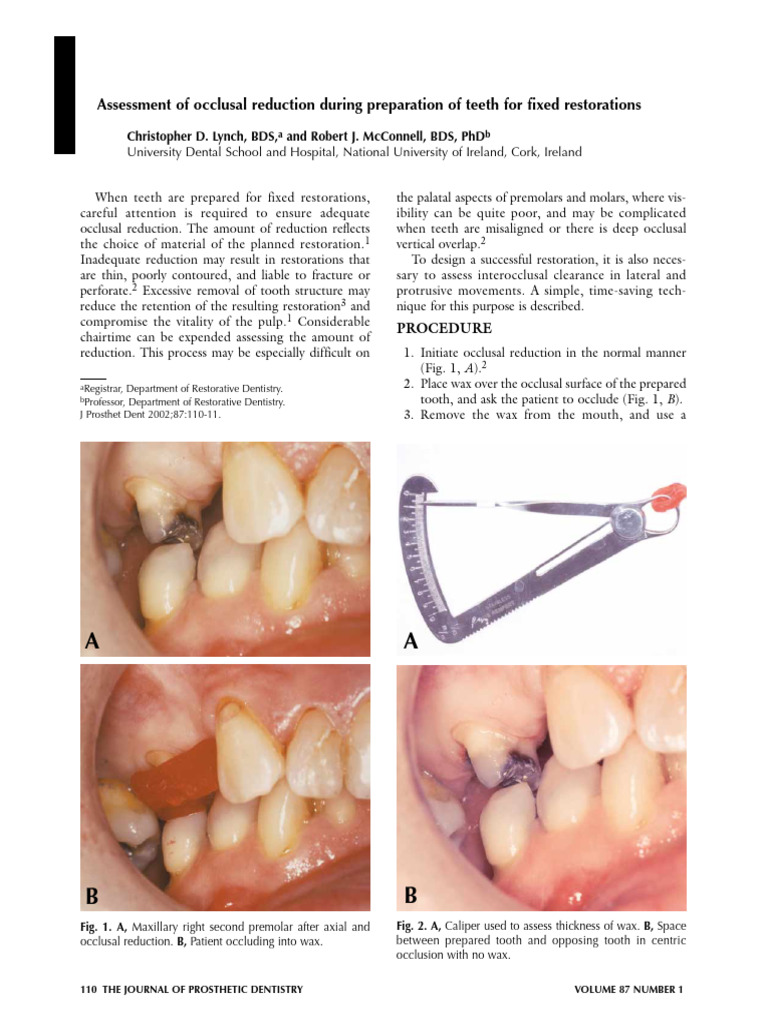 2002 - Assessment of Occlusal Reduction During Preparation of Teeth For ...