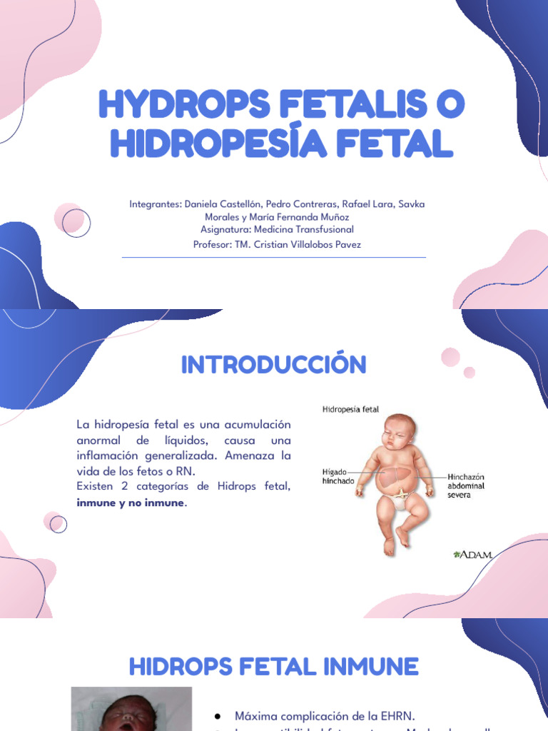 Hidropesía Fetal | PDF | El embarazo | Feto