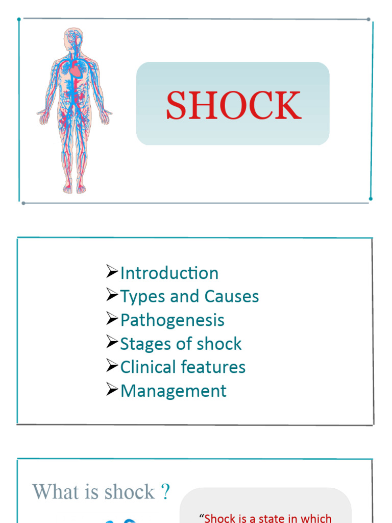 Shock Download Free Pdf Shock Circulatory Clinical Medicine