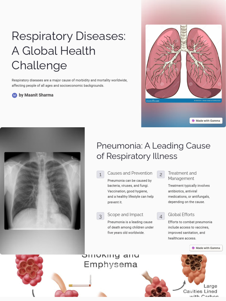 Respiratory-Diseases-A-Global-Health-Challenge Information | PDF ...