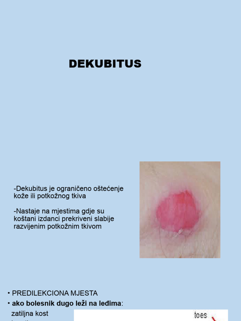 DEKUBITUS | PDF